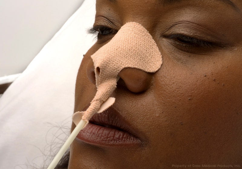 Tube feeding (경관식)방법 : 네이버 블로그