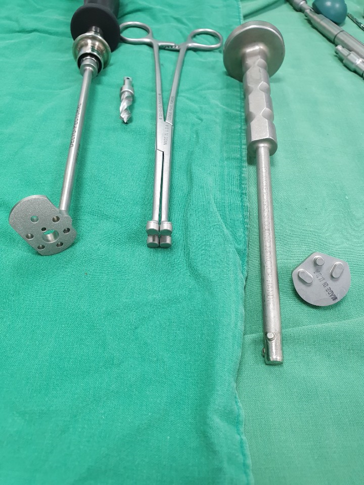 RTSA (exactech equinoxe) Dr.N : 네이버 블로그