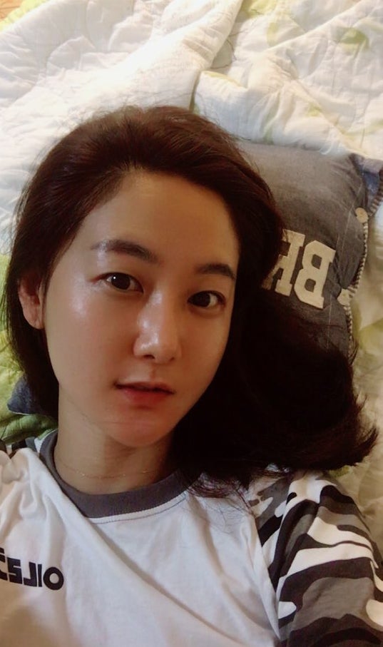 여드름 치료제 이소티논 1년 리얼 복용 후기 명현현상과 부작용 주의사항 그리고 효과후기 사진 있음 네이버 블로그