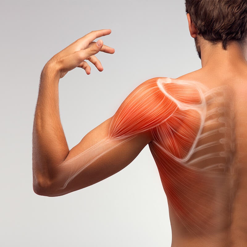 팔을 들때마다 어깨가 아프다면 대흉근pectoralis Major과 견갑하근subscapularis의 관계를 살펴보자