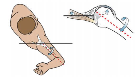 SLAP(Shoulder Superior Labrum Anterior to Posterior) Lesion - 어깨 상부 관절 ...