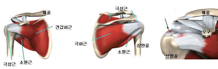 Pan의학자료회전근개 파열과 장해진단 기준정형외과 기초이론6 네이버 블로그