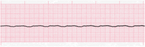 001. 심정지 대처 / Arrest 시 할 일 : 네이버 블로그