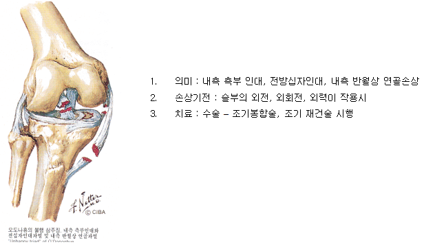 Pan의학자료무릎인대 파열과 장해진단 기준정형외과 기초이론12 네이버 블로그