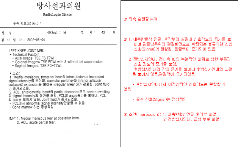 Pan의학자료무릎인대 파열과 장해진단 기준정형외과 기초이론12 네이버 블로그