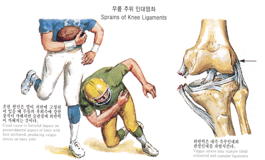 Pan의학자료무릎인대 파열과 장해진단 기준정형외과 기초이론12 네이버 블로그