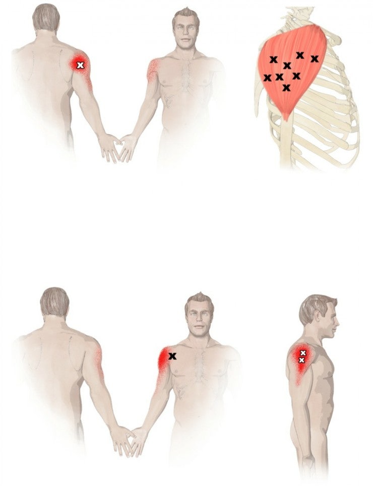 후면삼각근 Posterior Deltoid 후면삼각근 해부학어깨세모근 삼각근 통증 네이버 블로그