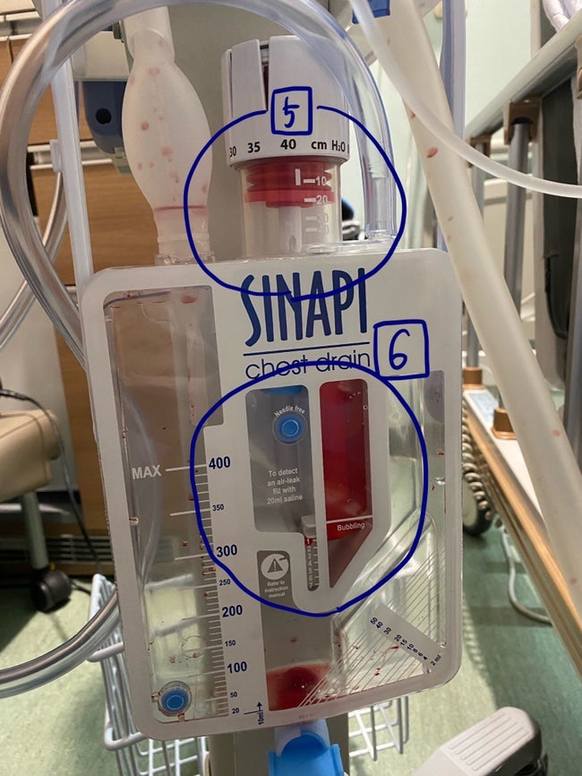 [Nursing] SINAPI Chest bottle 시나피 체스트 보틀 : 네이버 블로그