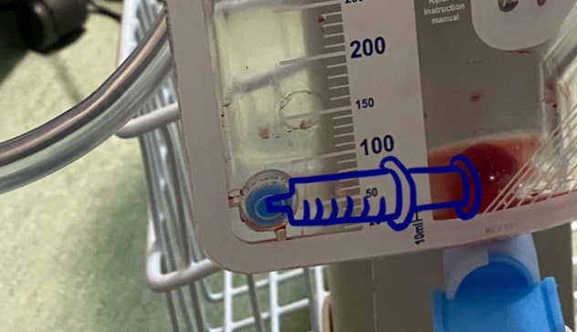 [Nursing] SINAPI Chest bottle 시나피 체스트 보틀 : 네이버 블로그