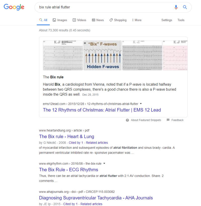 Bix rule, atrial flutter : 네이버 블로그