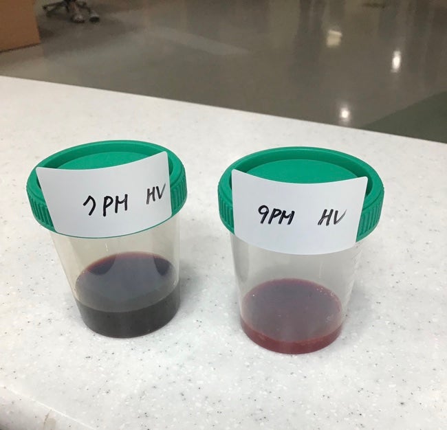 Nursing 수술 후 간호 대상자와 보호자 교육 네이버 블로그