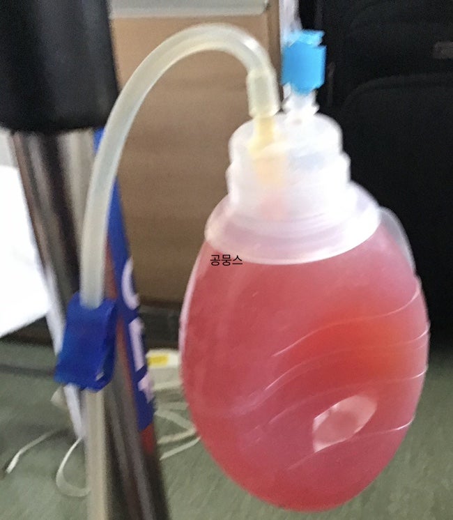 Nursing 수술 후 간호 대상자와 보호자 교육 네이버 블로그