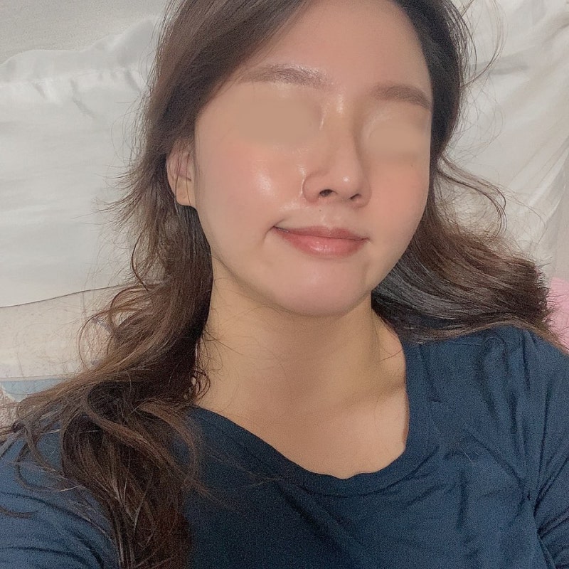 미사 피부관리 물톡스 후기 남겨요 미사여드름 골드라인뷰티 네이버 블로그