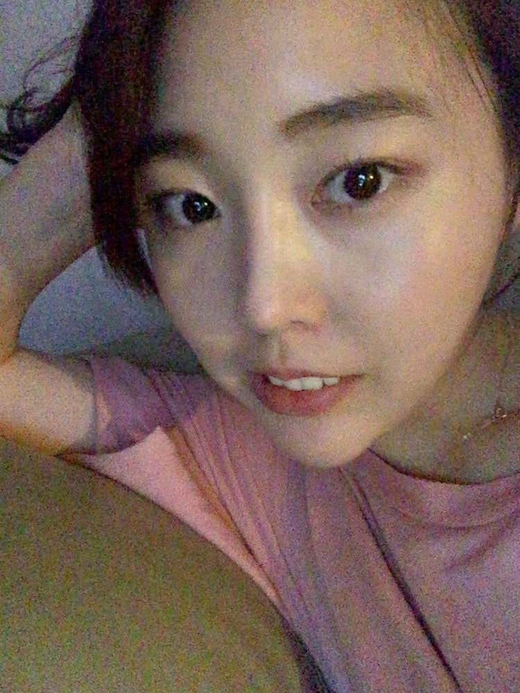 치아교정 후회 주의점 부작용 블랙트라이앵글 다 말해드릴게요 네이버 블로그