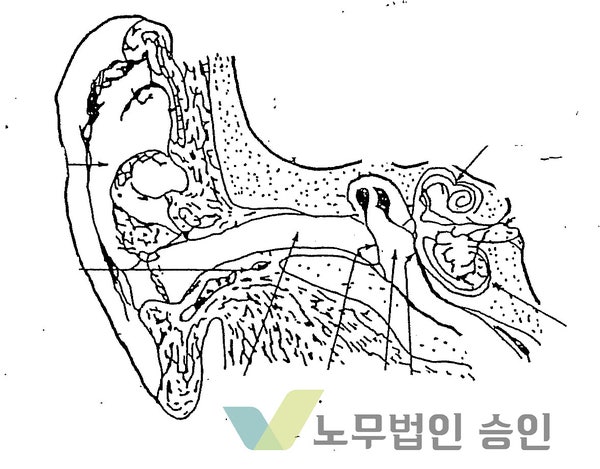 산업재해기준에 해당하는 조선소 용접공의 소음성난청 승인 사례 네이버 블로그
