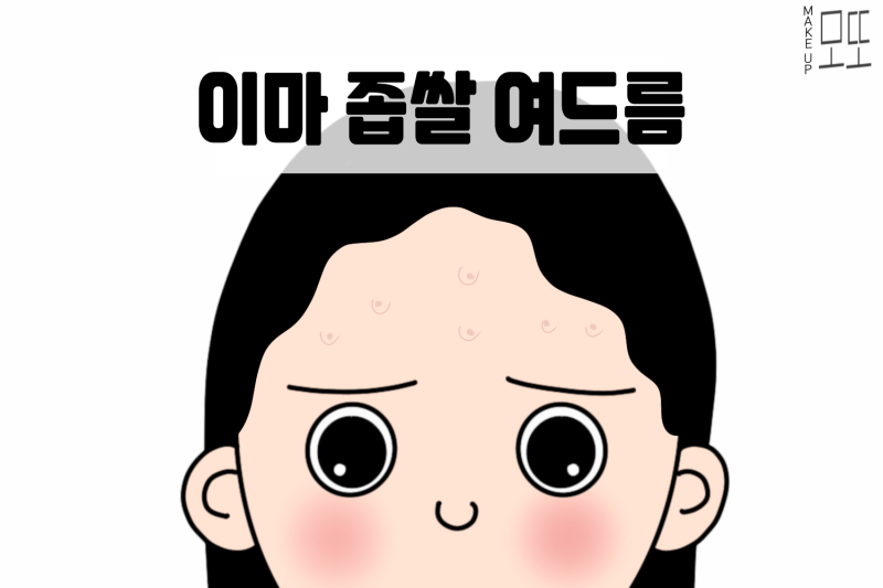 이마 좁쌀 여드름 원인 및 관리법 네이버 블로그