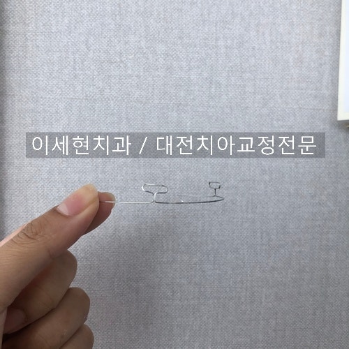 part3. 특수철사 (double keyhole, T-loop, L-loop, MEAW) : 네이버 블로그