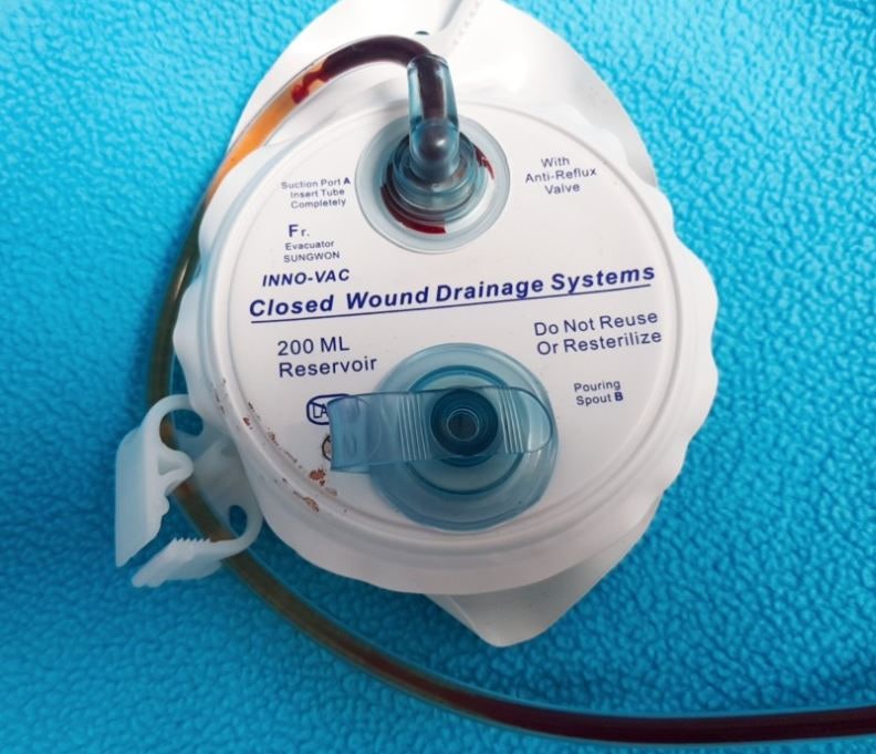 배액관 JP drain, Hemo vac 에 대해서 : 네이버 블로그
