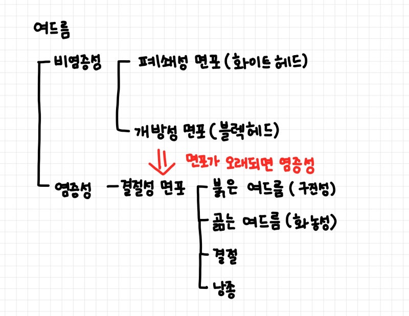 여드름 피부과 여드름약 총정리 크레오신티 에피외용액 다크린외용액 디페린 크림 디페린겔 나딕사크림 에피듀오겔