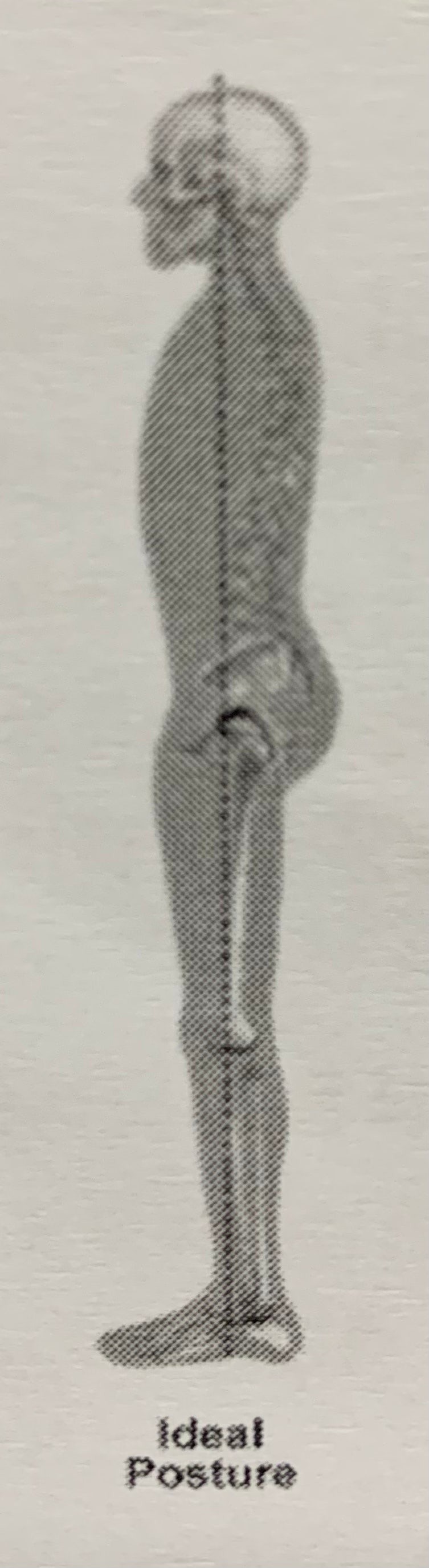 Kendal의 체형불균형-Kyphotic-Lordotic posture 울산피티 울산삼산피티 달동피티 신정동피티 옥동피티 ...