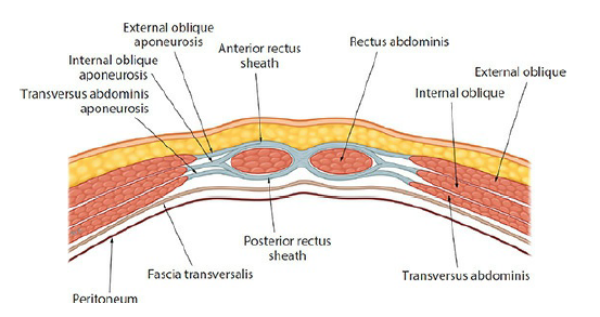US guided rectus sheath block : 네이버 블로그