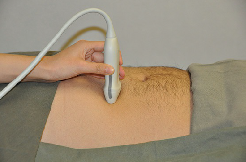 US guided rectus sheath block : 네이버 블로그