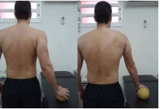 Effects of adding scapular stabilization exercises to a periscapular ...