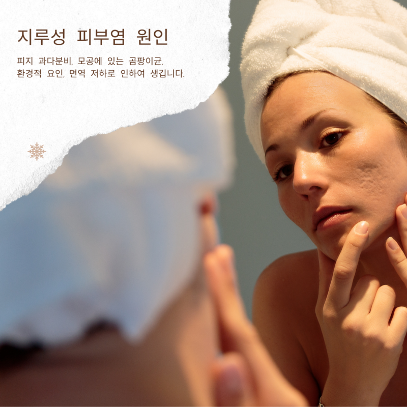 지루성 피부염에 관한 모든 것 원인 증상 치료방법 네이버 블로그
