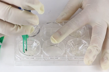 [WPI] 세포 TEER 측정기 - EVOM 2 (Voltage/Ohm meter) : 네이버 블로그