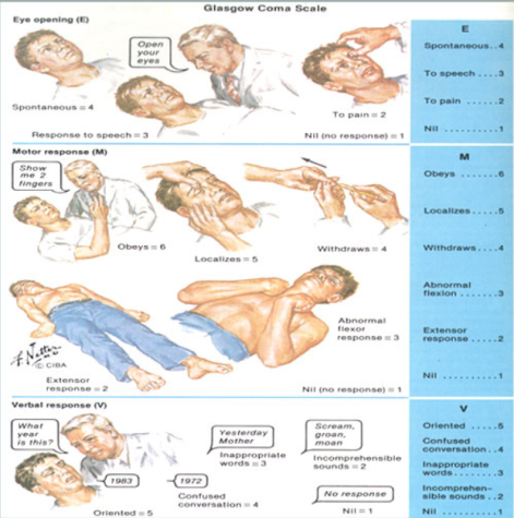 GCS(Glosgow Coma Scale)-의식사정 : 네이버 블로그