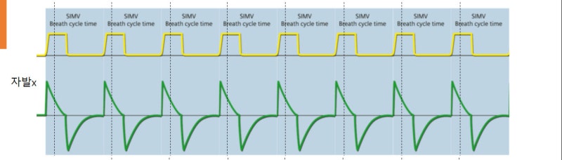 (Servo ventilator) SIMV 모드에서 강제호흡구간, breath cycle time, trigger window ...