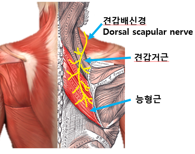 견갑배신경포착dorsal Scapular Nerve Entrapment 목통증등결림 천안아산 달천한의원 네이버 블로그
