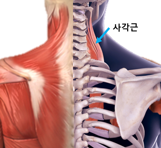 견갑배신경포착dorsal Scapular Nerve Entrapment 목통증등결림 천안아산 달천한의원 네이버 블로그