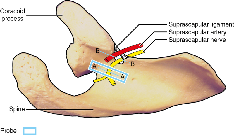 견갑상신경(suprascapular nerve) : 네이버 블로그
