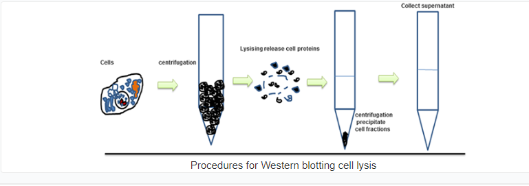[Proteomics/protocol]Protein extraction for proteomics : 프로테오믹스분석을 위한 ...
