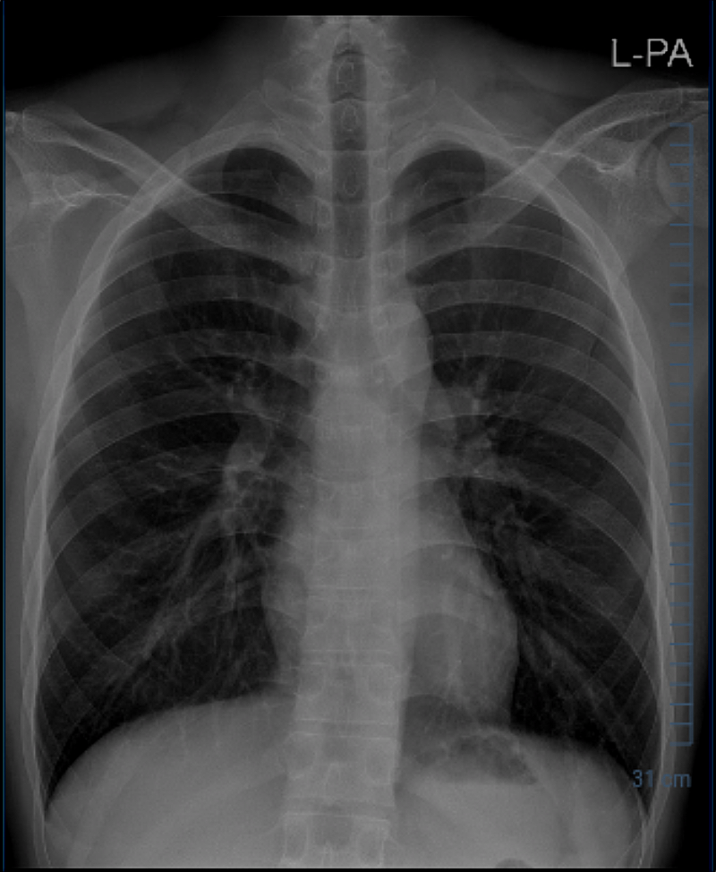 신규 간호사가 알아야 할 기본 X-ray 판독법 : 네이버 블로그