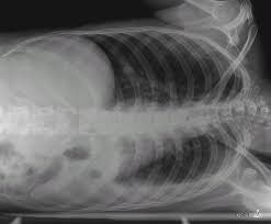 X-ray 검사 -chst AP,PA / Abdomen flat & upright / Decubitus, Oblique. KUB ...