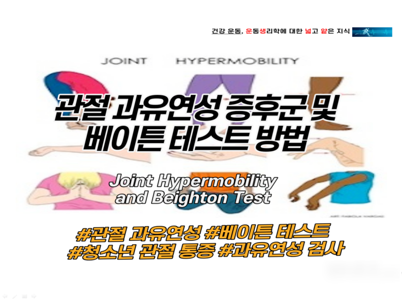 관절 과유연성 증후군 및 베이튼 테스트 방법 - Joint Hypermobility and Beighton Test : 네이버 블로그