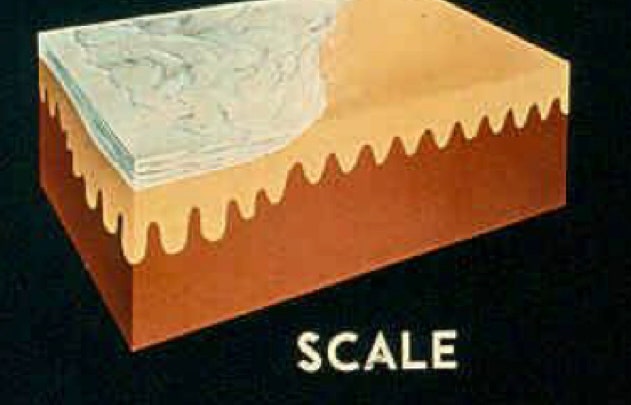 [PK 생활] 피부과. pruritus, macule, papule, vesicle, bulla, pustule, wheal ...