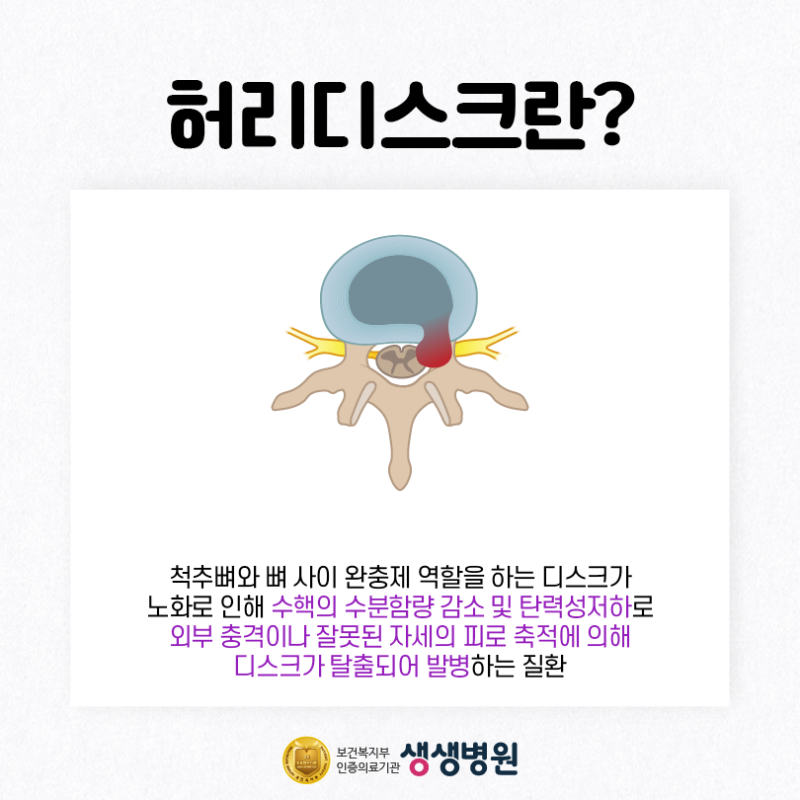 부천 허리디스크 단계별 증상과 맞춤 치료법 내시경 특화 치료 병원 네이버 블로그