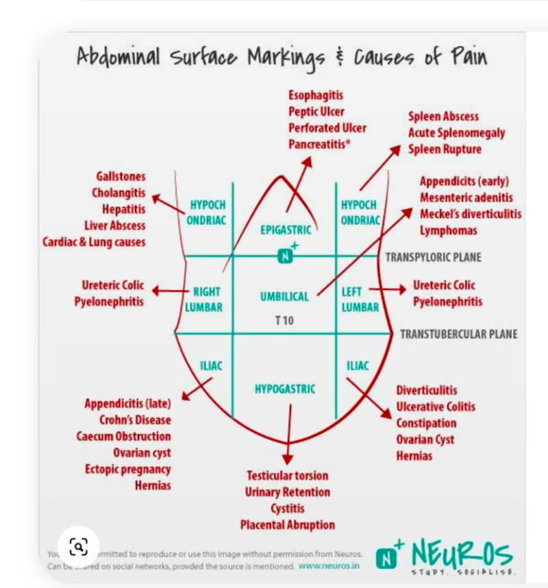 (미국간호대학원) Abd pain : 네이버 블로그