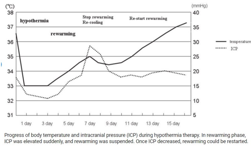 TTM(Target Temperature Management), hypothermia therapy, Articsun 임상적용 ...