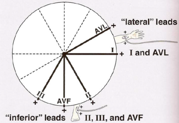 심전도 검사 (EKG, Electrocardiogram)에 대해서 [의미/붙이는법/판독] : 네이버 블로그