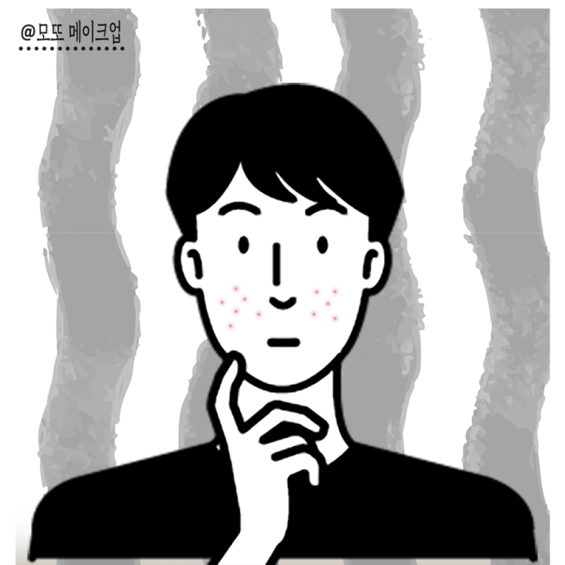 여드름 부위별 원인 요약본 이마 볼 미간 인중 네이버 블로그