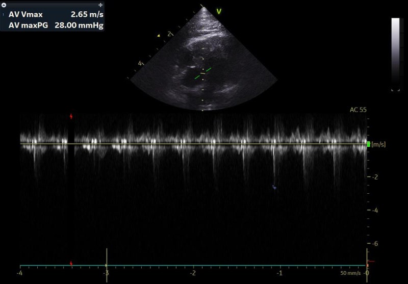 고양이 HCM(Hypertrophic Cardiomyopathy) 고양이 SAM(Systolic Anterior Motion ...