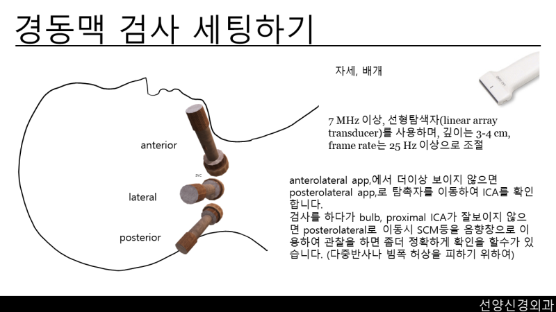 경동맥협착증 검사를 위한 초음파 설정 방법 네이버 블로그