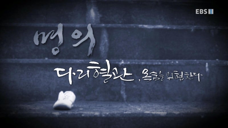 하지정맥류의 초기증상 치료법은 무엇일까 Ebs 명의 네이버 블로그