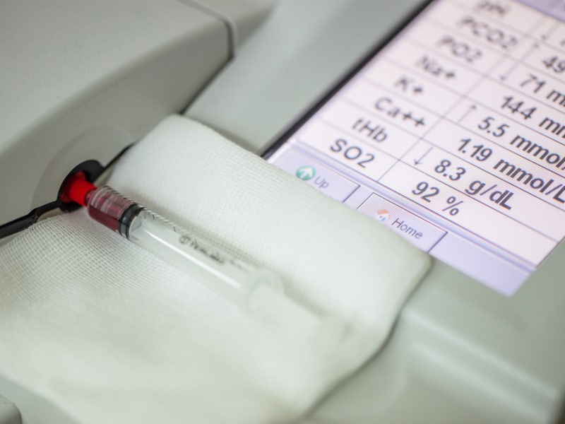 ABGA 해석하는 간단한 방법 : 네이버 블로그