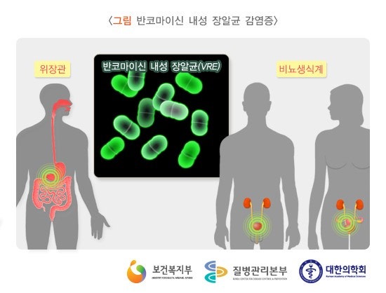[내성균] VRE, CRE, MRSA, MRAB 증상 및 치료, 감염관리 : 네이버 블로그