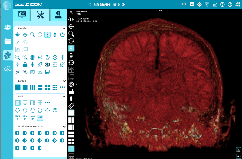 [p2] 무료 DICOM viewer - Postdicom, Radiant**추천 : 네이버 블로그